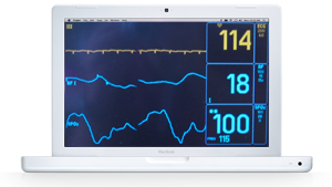 MacBook on life support, but Apple not pulling the plug yet - Ars Technica