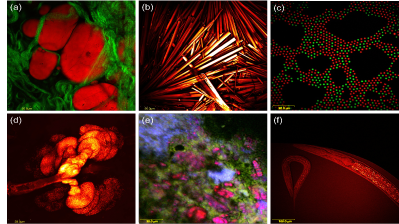 Beating the diffraction-limit using CARS microscopy - Ars Technica