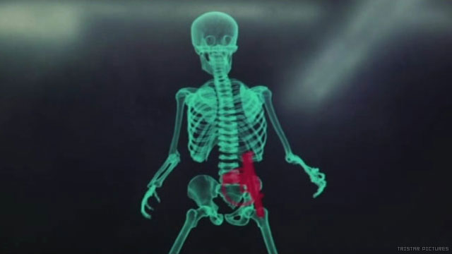 The physics and biology of the TSA’s backscatter security scanners ...