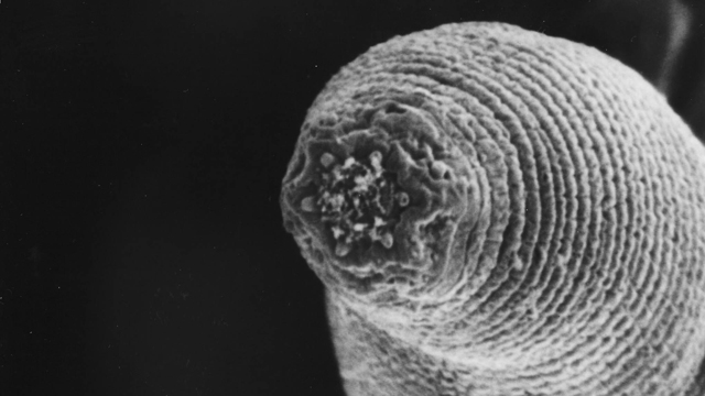 Worms from the bowels of the earth: meet Halicephalobus mephisto - Ars ...