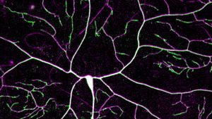 Modeling neuron death with real and simulated decapitations - Ars Technica