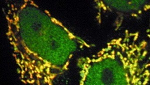 Genetic computing used to kill specific cancer cells - Ars Technica