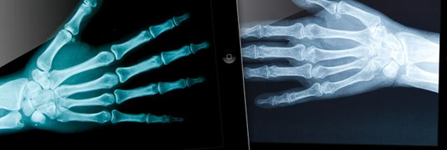 X-rays and iPads: The network healthcare evolution | Ars Technica
