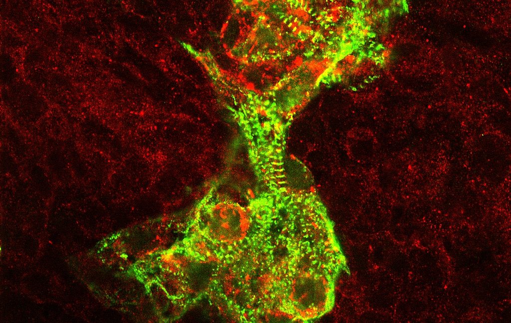 Heart tissue derived from embryonic stem cells doesn't skip a beat ...