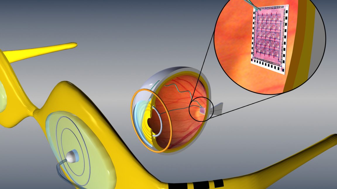 Sight for sore eyes: optical prosthetic mimics retina functionality ...