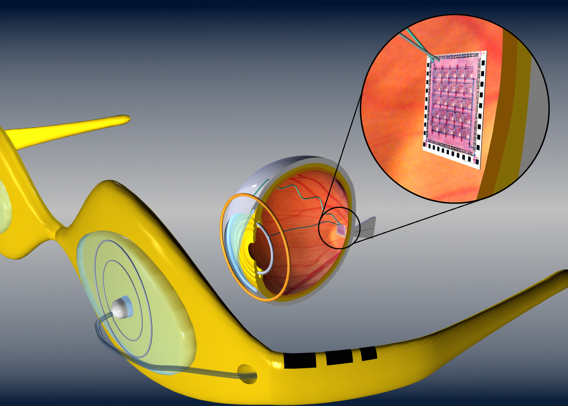 Sight for sore eyes: optical prosthetic mimics retina functionality ...