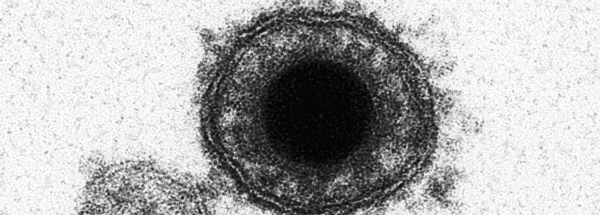 Self-boosting vaccine could give single-shot immunity | Ars Technica