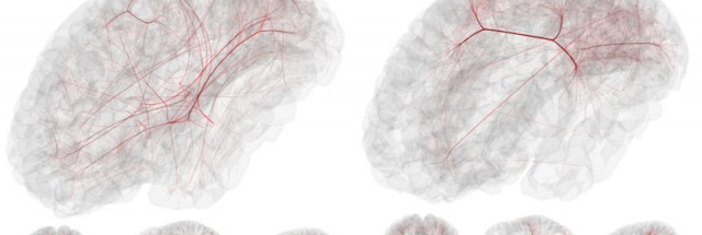 Some comatose brains remain active, but can’t enable conscious actions ...