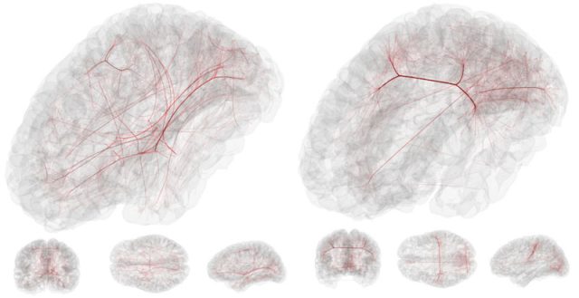 Some comatose brains remain active, but can't enable conscious actions ...