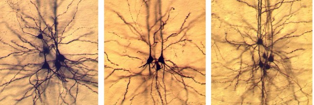 Reshaping the brain: scientists reprogram neurons after birth | Ars ...