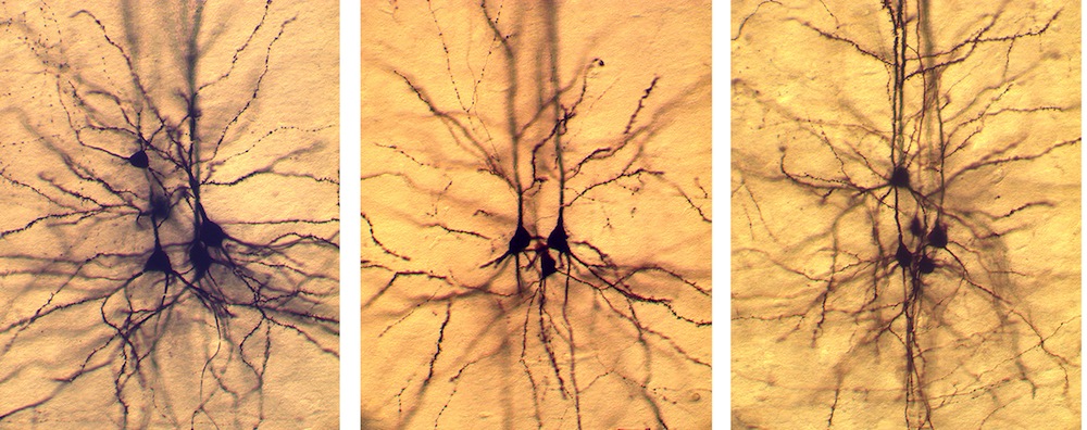 Reshaping the brain: scientists reprogram neurons after birth - Ars ...