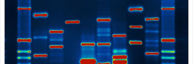 Researchers find a completely new DNA binding protein | Ars Technica