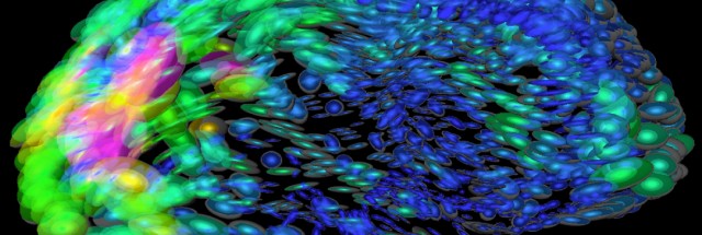 Understanding the brain of a man with no conscious memory | Ars Technica