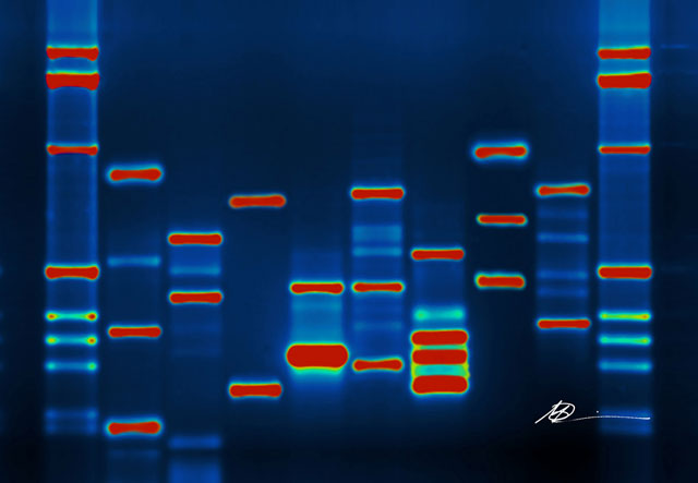 Supreme Court blocks patenting of genomic DNA (Updated) - Ars Technica