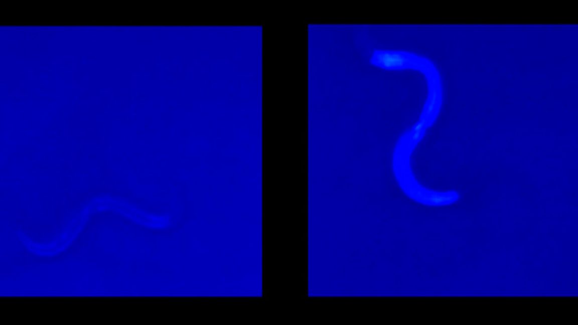Blue cells of death mark the end of a worm’s life - Ars Technica