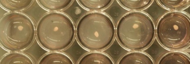 Human stem cells used to grow a mini-liver in mice | Ars Technica