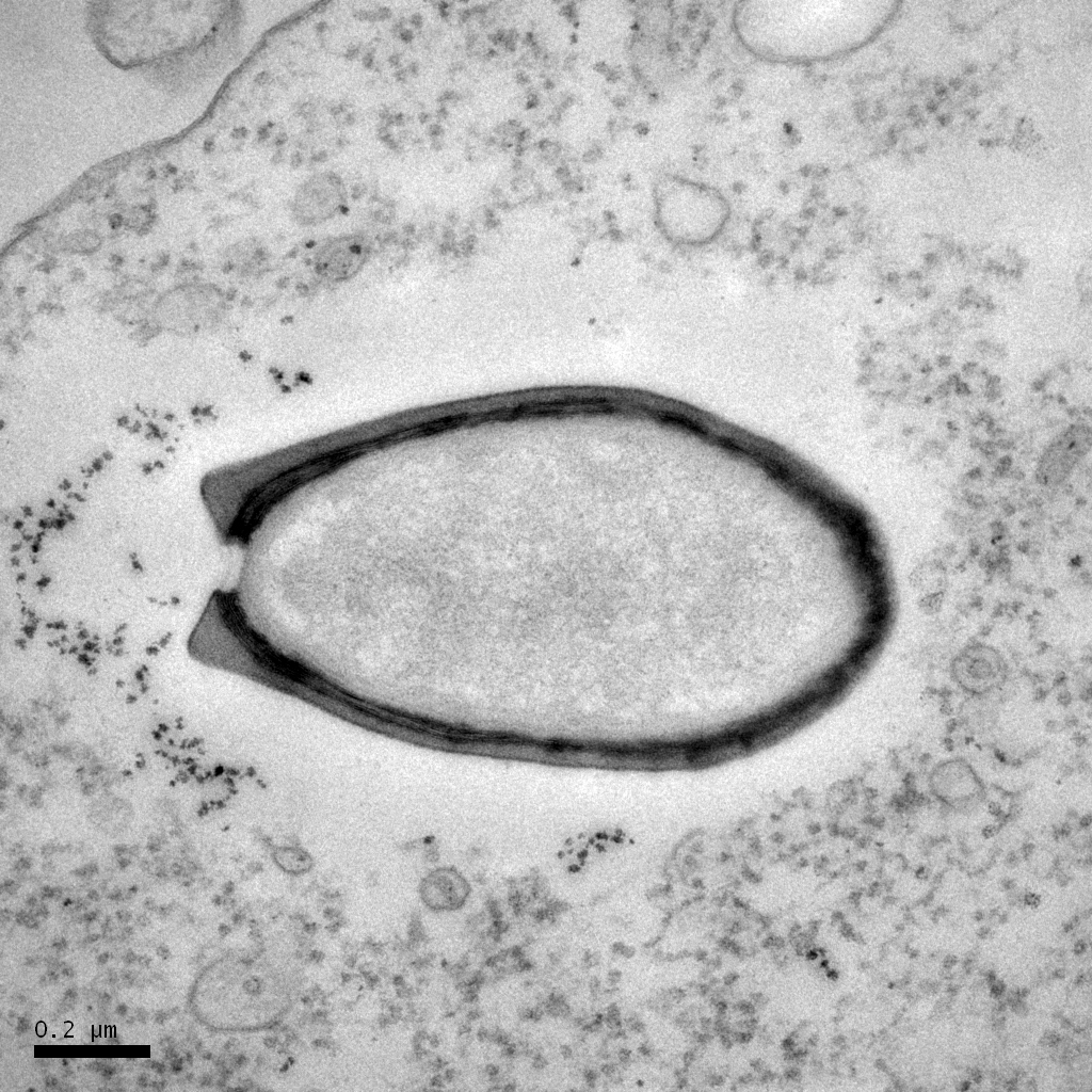 Largest viral genome yet carries 2,300 genes that are new to biology ...
