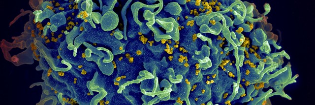 How we make immune cells that keep the body from attacking itself | Ars ...