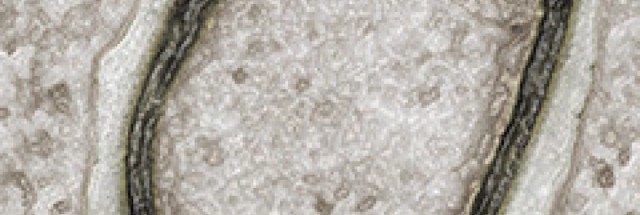 Scientists revive largest virus yet from 30,000-year-old permafrost ...