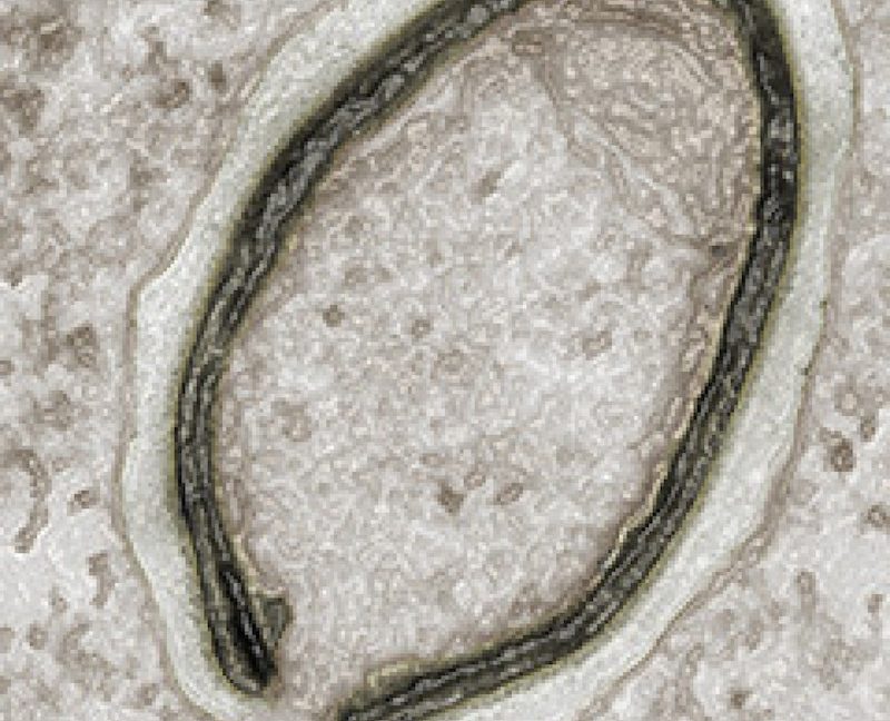 Scientists revive largest virus yet from 30,000-year-old permafrost ...