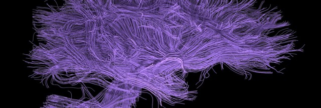 Autism mutations strike genes active in the developing brain | Ars Technica