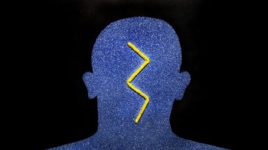 Can you supercharge your brain? - Ars Technica