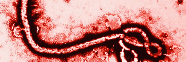 Understanding The Ebola Virus Ars Technica