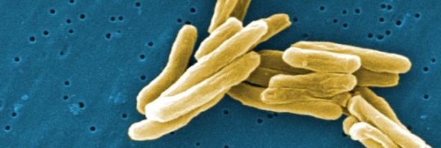 Collapse of Soviet health system may have aided spread of tuberculosis ...
