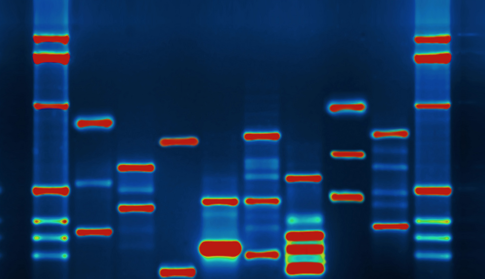 Your DNA is everywhere. Can the police analyze it? - Ars Technica