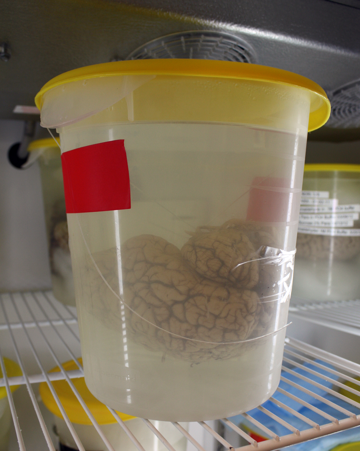 To digitize a brain, first slice 2,000 times with a very sharp blade ...