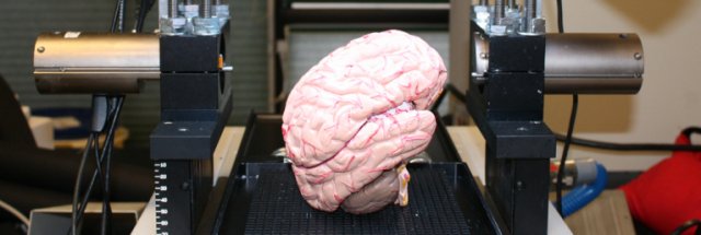 To digitize a brain, first slice 2,000 times with a very sharp blade ...