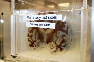 The evolutionary mystery of gigantic human brains - Ars Technica