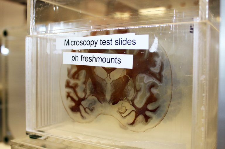 To digitize a brain, first slice 2,000 times with a very sharp blade ...