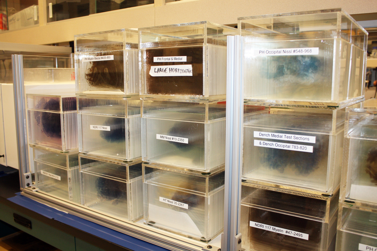 To digitize a brain, first slice 2,000 times with a very sharp blade ...