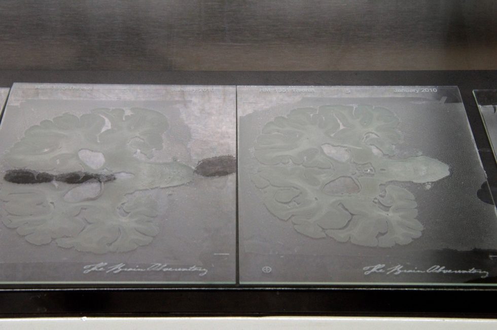 To digitize a brain, first slice 2,000 times with a very sharp blade ...