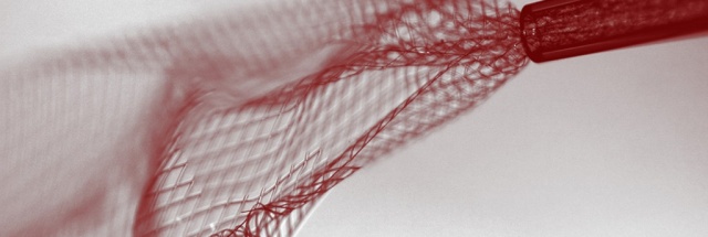 Injectable electronics could be used to monitor brain activity | Ars ...