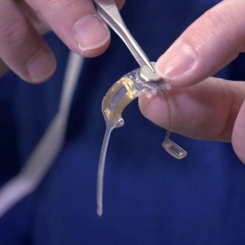 Tag: argus ii - Ars Technica