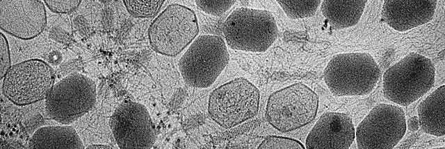 Vast, uncharted viral world discovered on human skin | Ars Technica