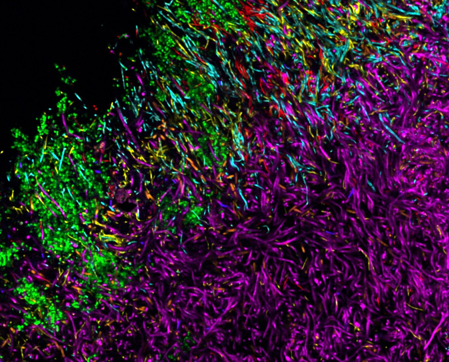 The gunk on your teeth is beautiful and well organized - Ars Technica