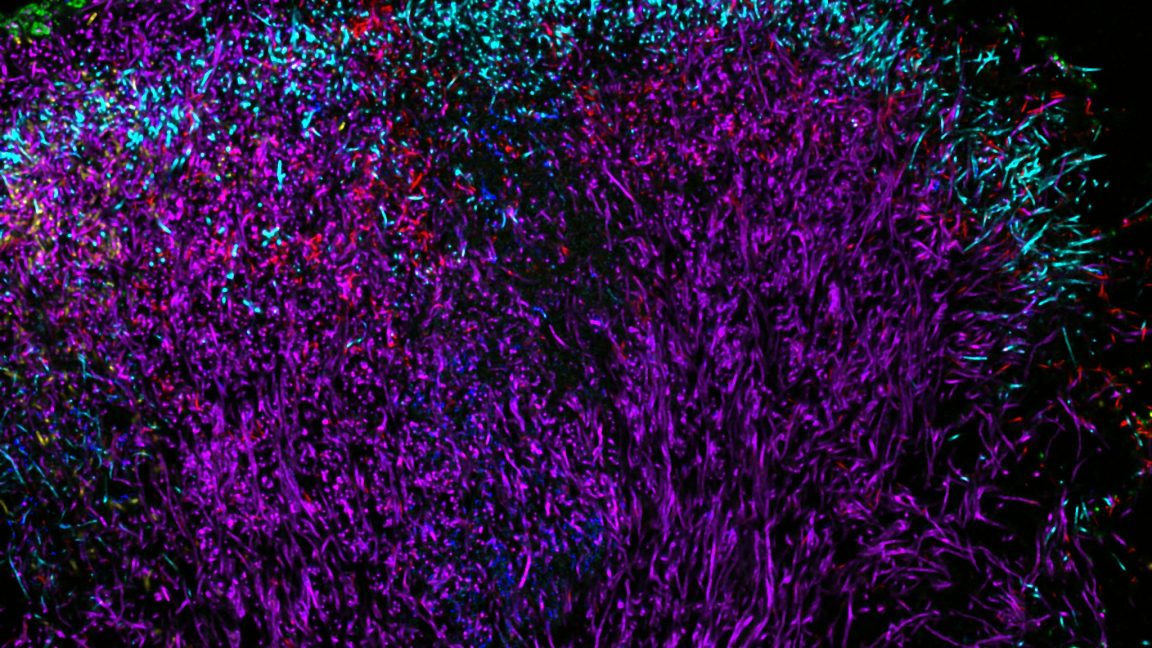 The gunk on your teeth is beautiful and well organized - Ars Technica