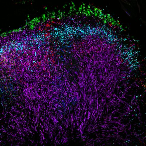 The gunk on your teeth is beautiful and well organized - Ars Technica