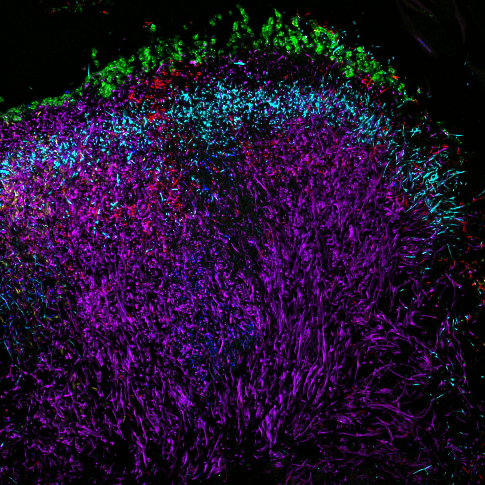 The gunk on your teeth is beautiful and well organized - Ars Technica