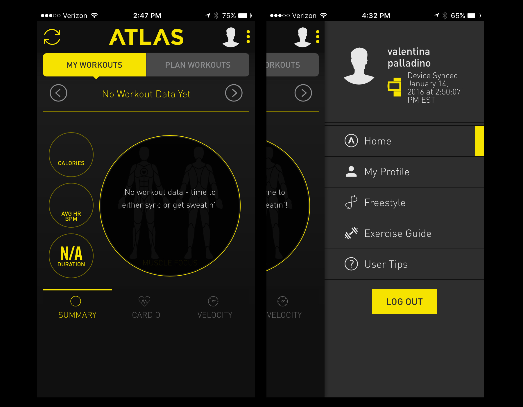 Atlas Wristband review: Finally, a fitness tracker for the gym rats ...