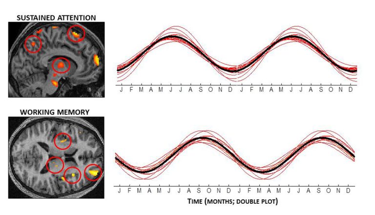 Your brain operates differently depending on the time of year - Ars ...