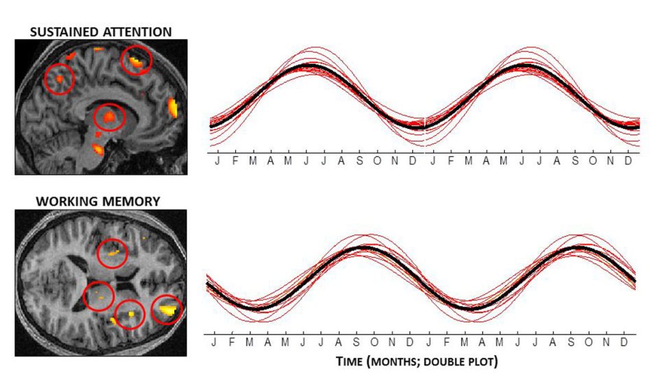 Your brain operates differently depending on the time of year - Ars ...