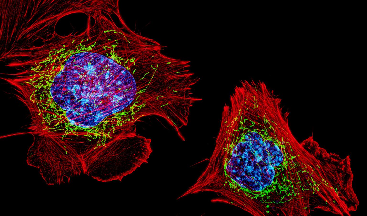 US takes first steps toward approving babies with three genetic parents ...