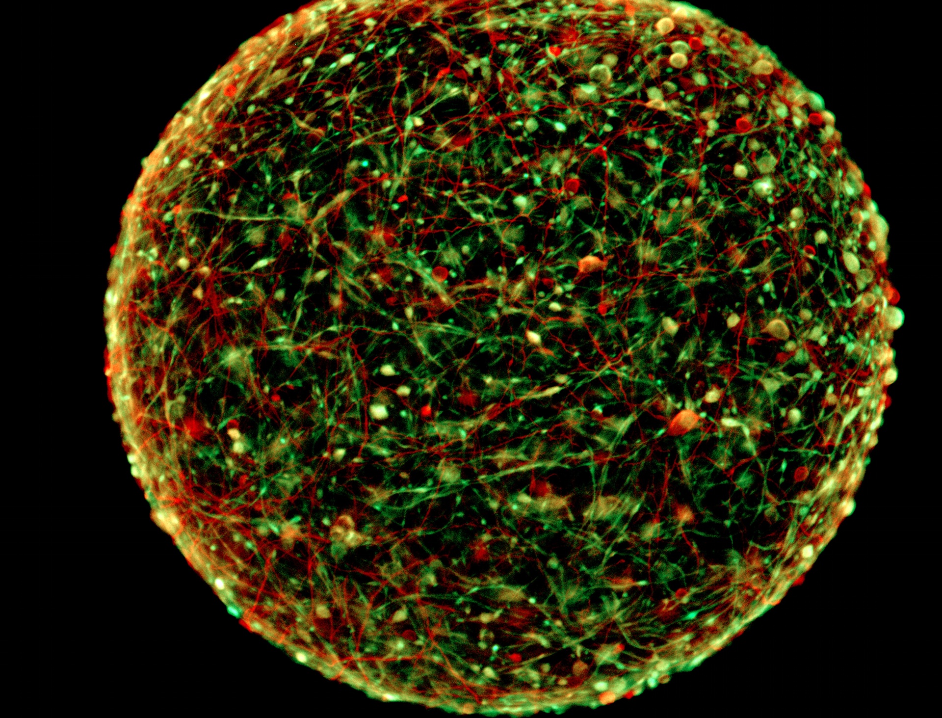 With a few skin cells, scientists can make mini, thinking version of ...
