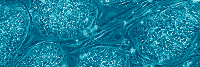 Essence of stem cells found: Key ingredients protect, heal the brain ...