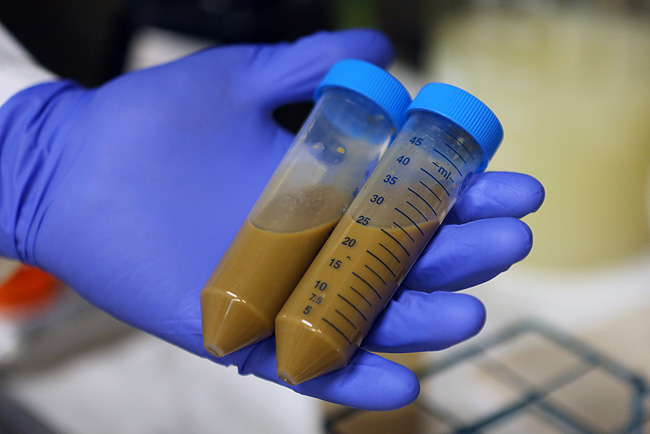 Drugs, wine, mushy poops explain gut microbe variation—but just a ...