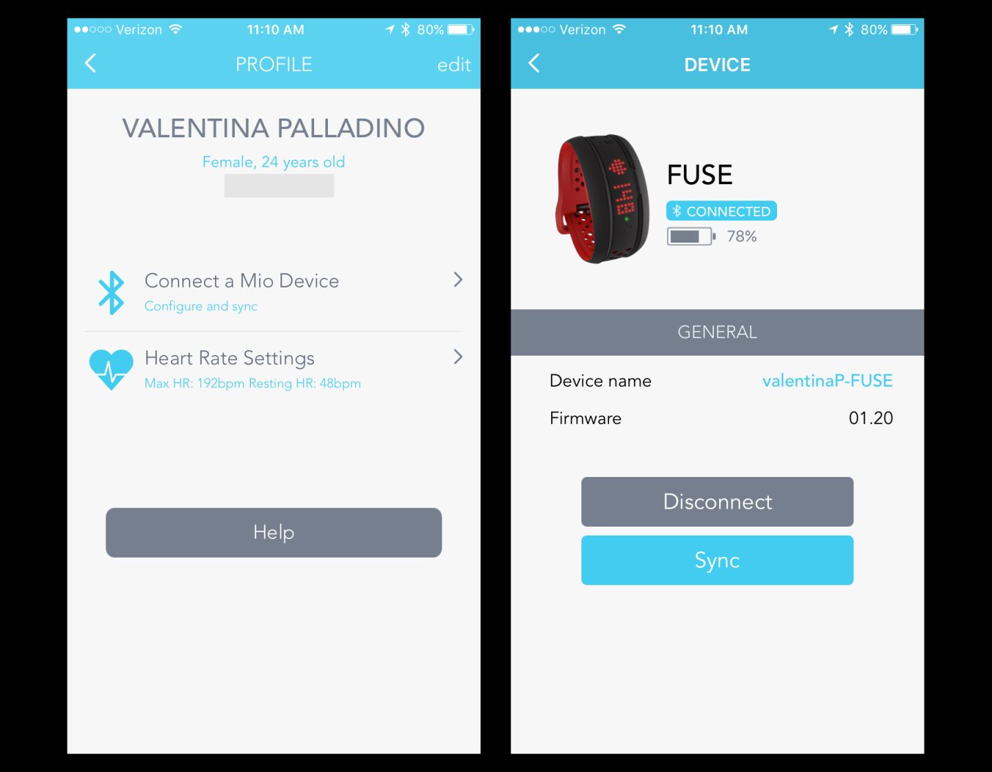 Mio Fuse reviewed: A fitness band that works better than it looks - Ars ...
